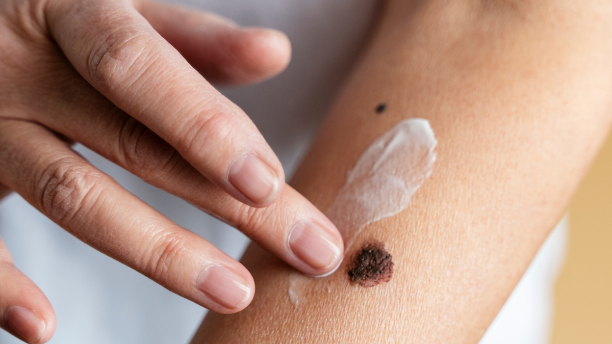 Skin Health & Skin Cancer: Why Your Skin Needs Year-Round Care — Even ...